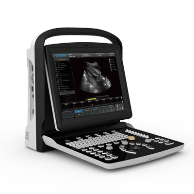 Chison ultrasound systems Archives - Redstone Healthcare